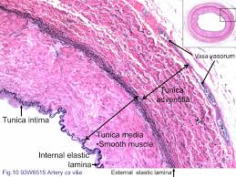 Abdominal Aortic Aneurysm – Sonographic Tendencies