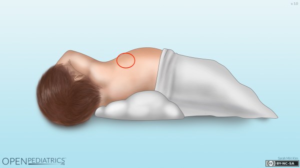 ill_chest-physiotherapy-positions-lower-lobes-right-lateral-basal ...