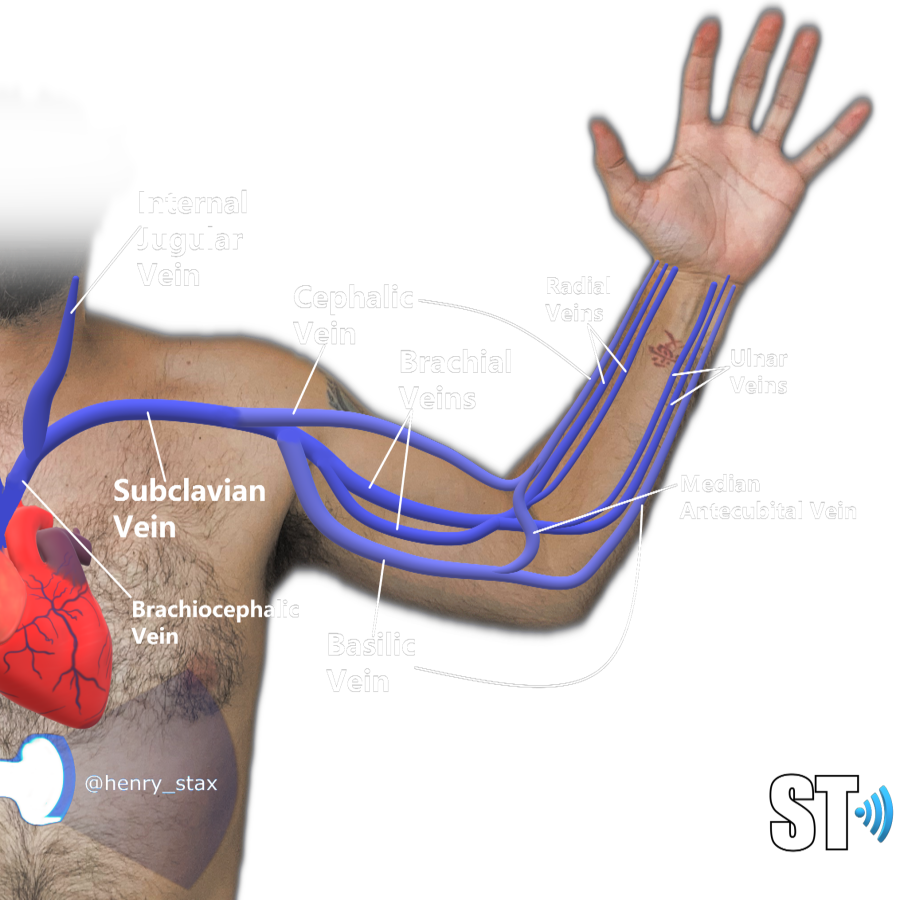 Upper Extremity Venous Doppler – Sonographic Tendencies