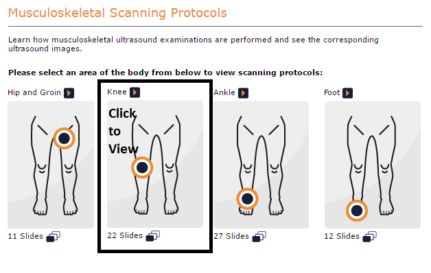 Musculoskeletal Ultrasound a Primer – Sonographic Tendencies