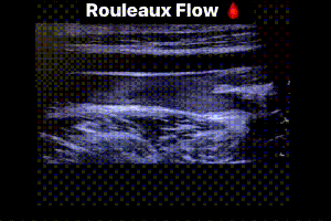 Rouleaux – Sonographic Tendencies
