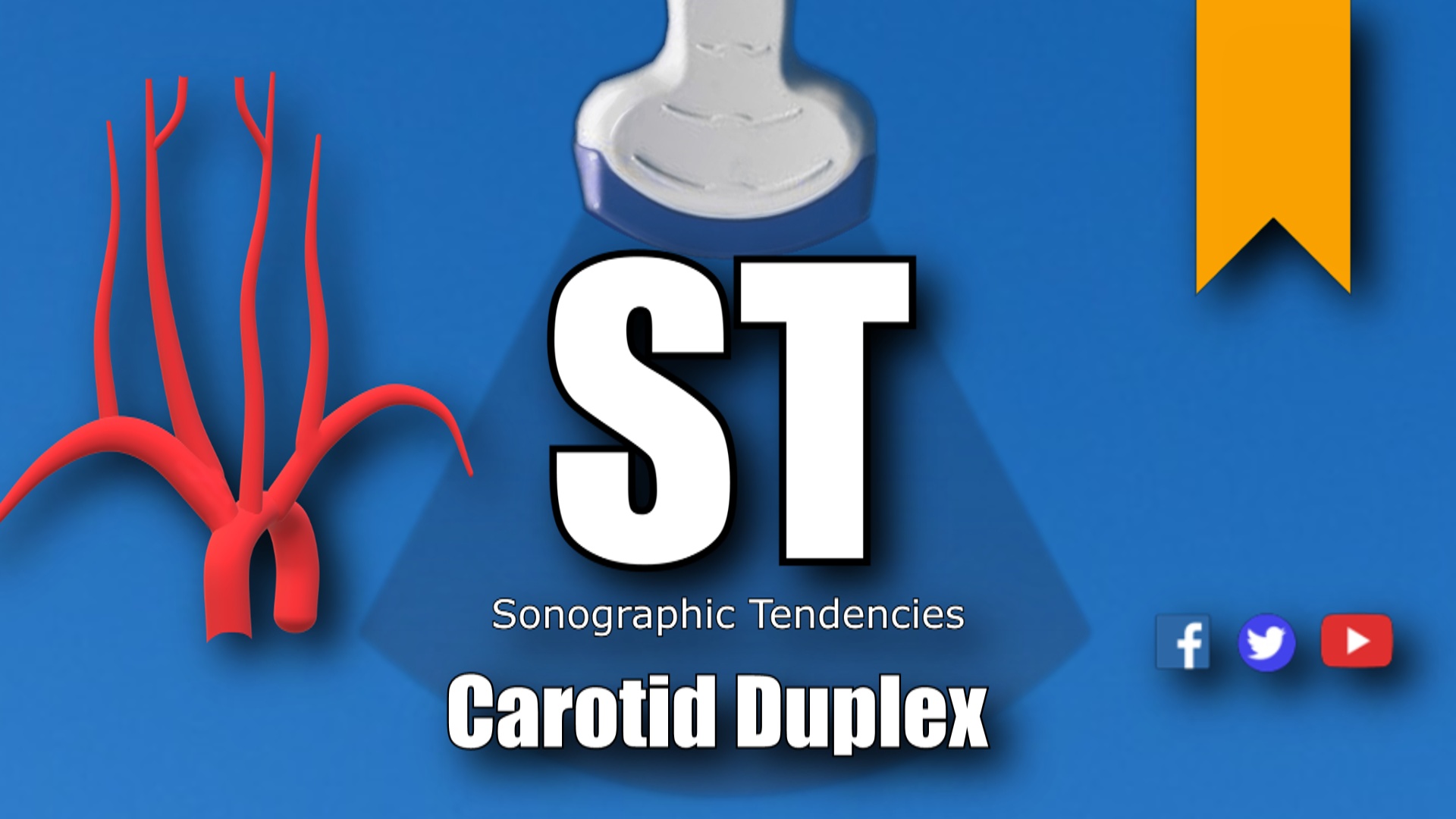 Carotid Duplex – Sonographic Tendencies