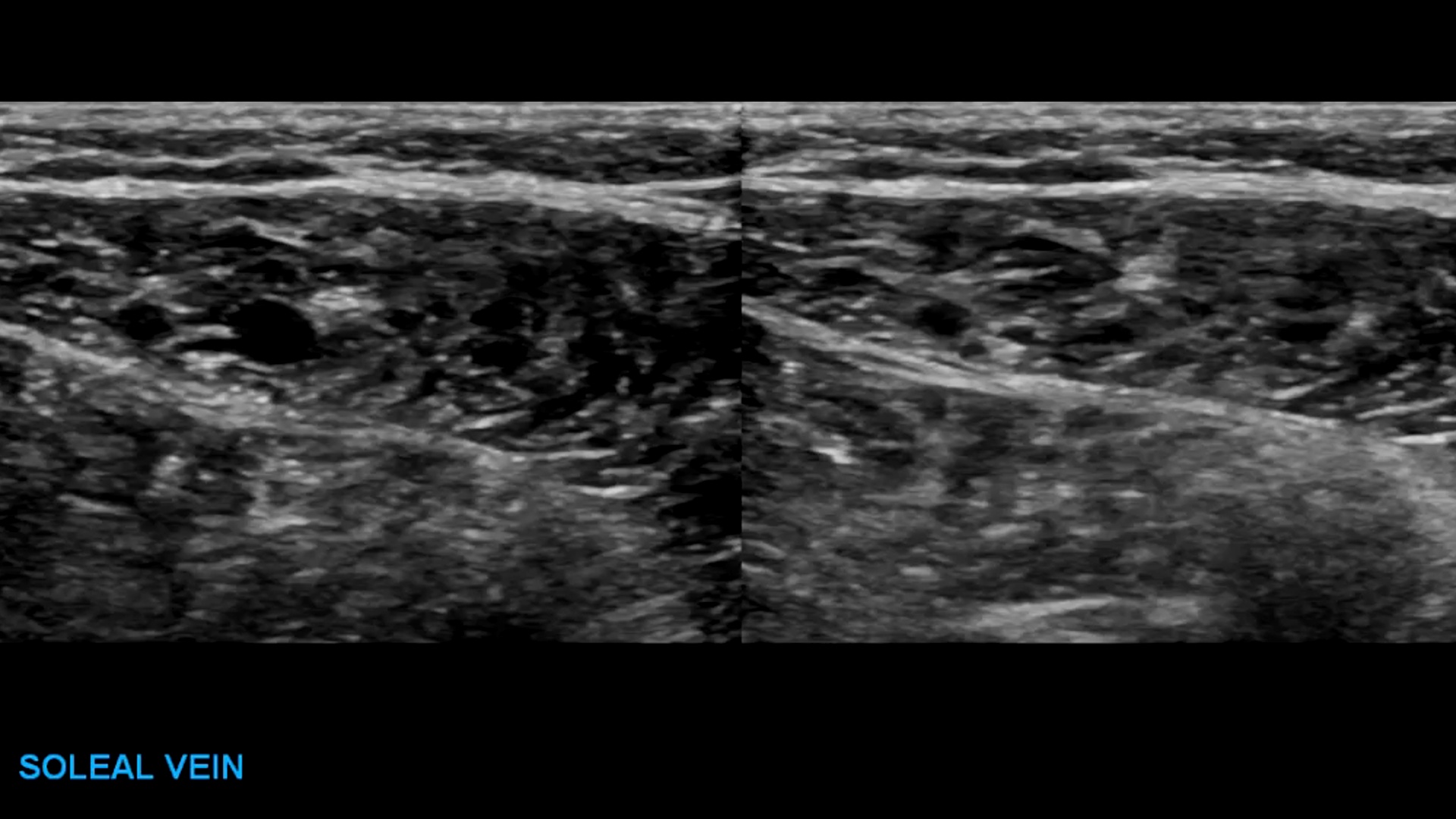 image16 – Sonographic Tendencies