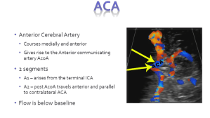 Transcranial Doppler – Sonographic Tendencies