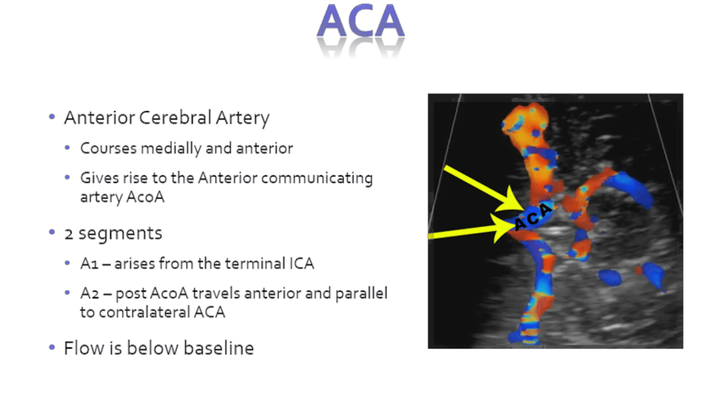 Transcranial Doppler – Sonographic Tendencies