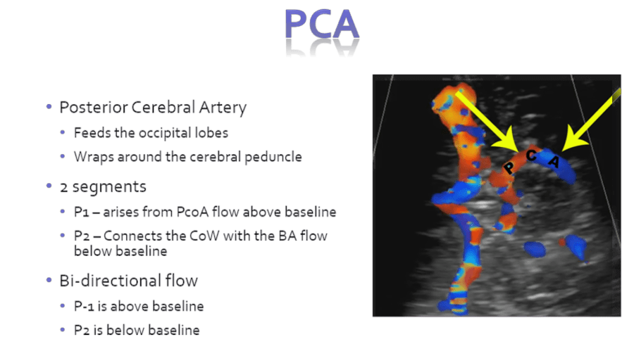 Transcranial Doppler – Sonographic Tendencies
