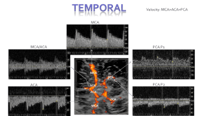 Transcranial Doppler – Sonographic Tendencies