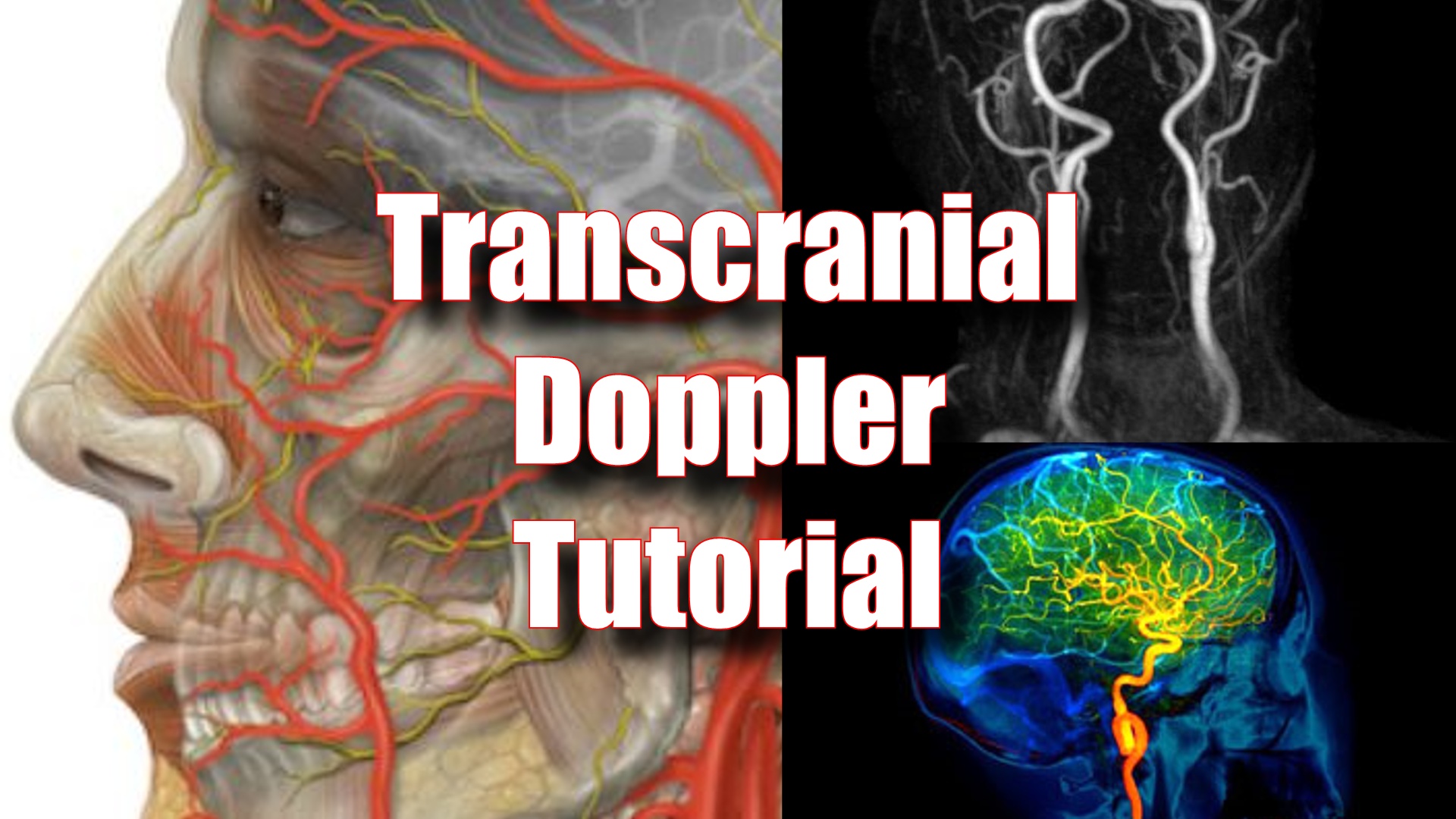 vascular – Sonographic Tendencies