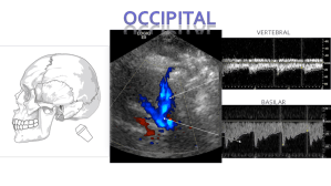 Transcranial Doppler – Sonographic Tendencies