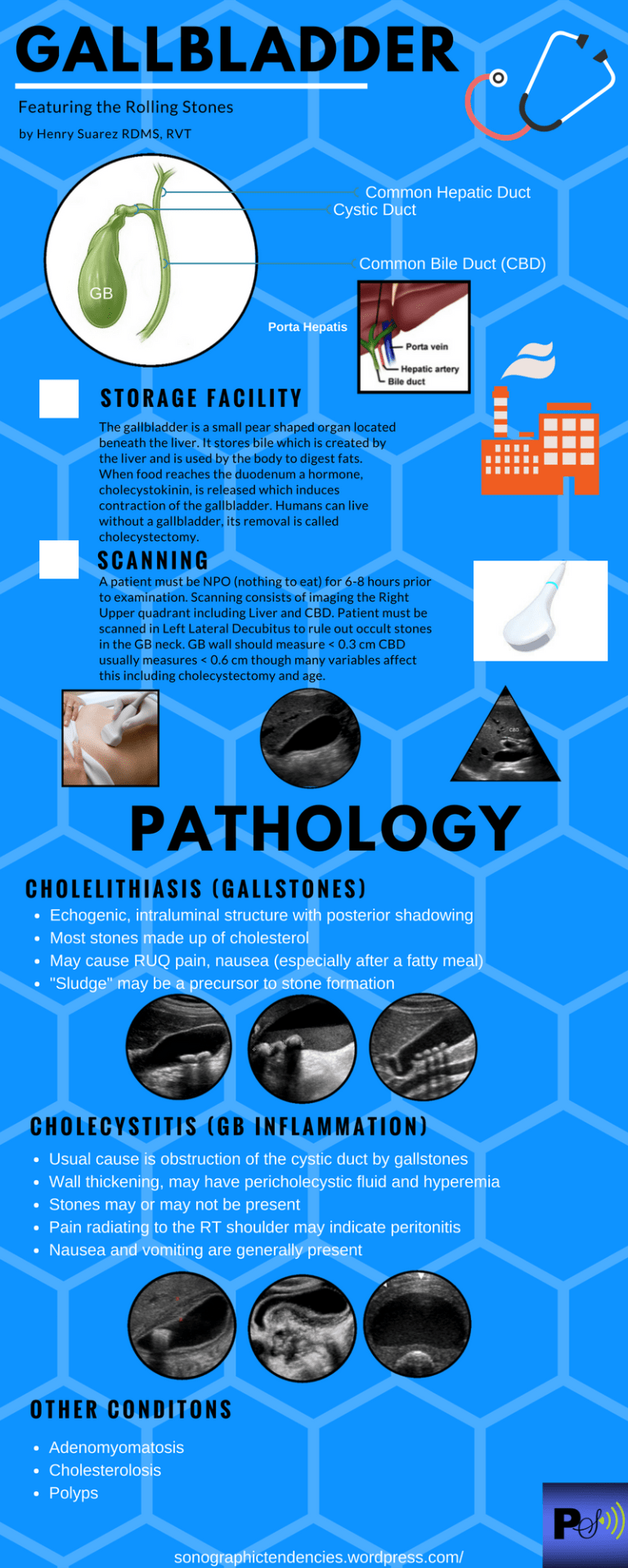 Gallbladder Infographic – Sonographic Tendencies