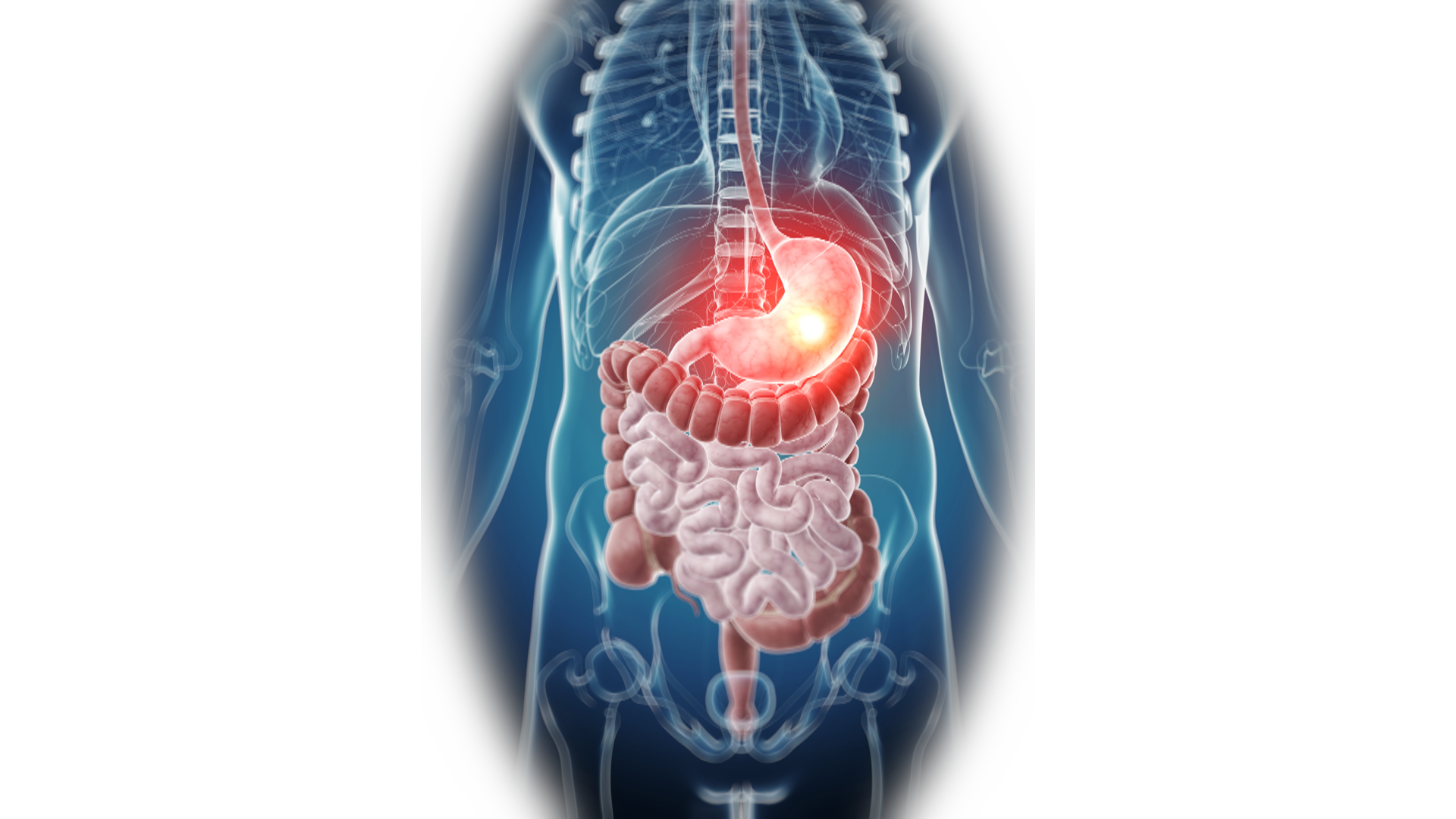 Gastrointestinal Sonography – Sonographic Tendencies