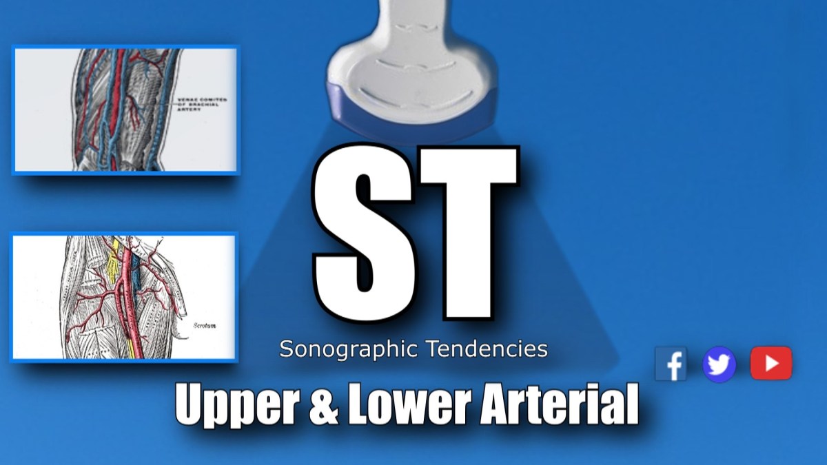 Arterial Doppler/Duplex of the Lower Extremities – Sonographic Tendencies