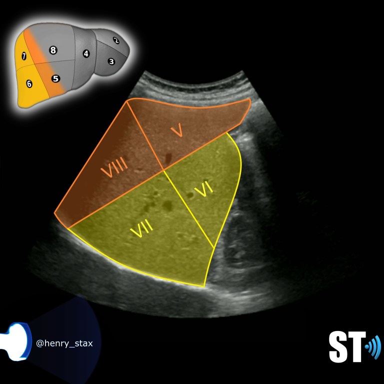 Couinaud’s Liver Segments – Sonographic Tendencies