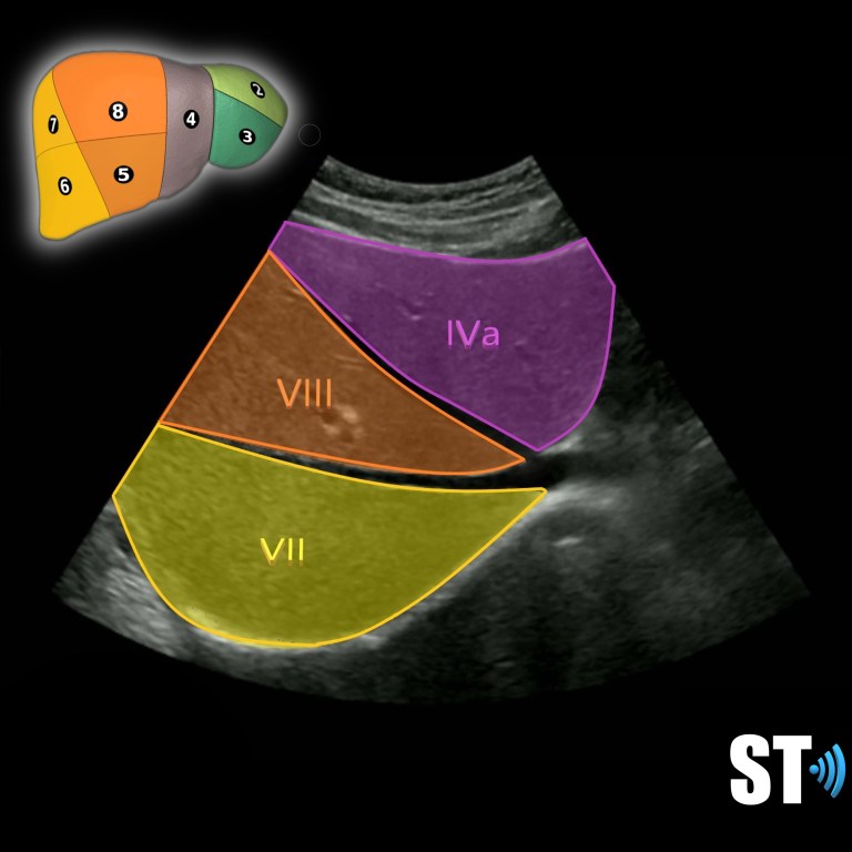 Couinaud’s Liver Segments – Sonographic Tendencies