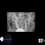 Renal Pathology – Sonographic Tendencies