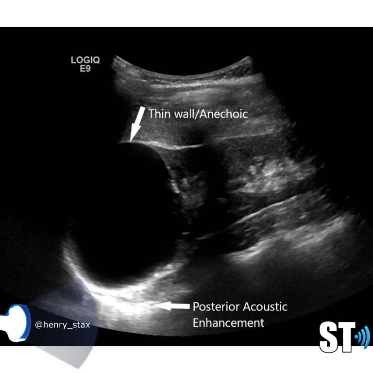 Renal Pathology – Sonographic Tendencies