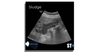 Gallbladder Sludge – Sonographic Tendencies