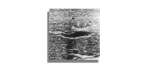 Gallbladder and Biliary Pathology – Sonographic Tendencies