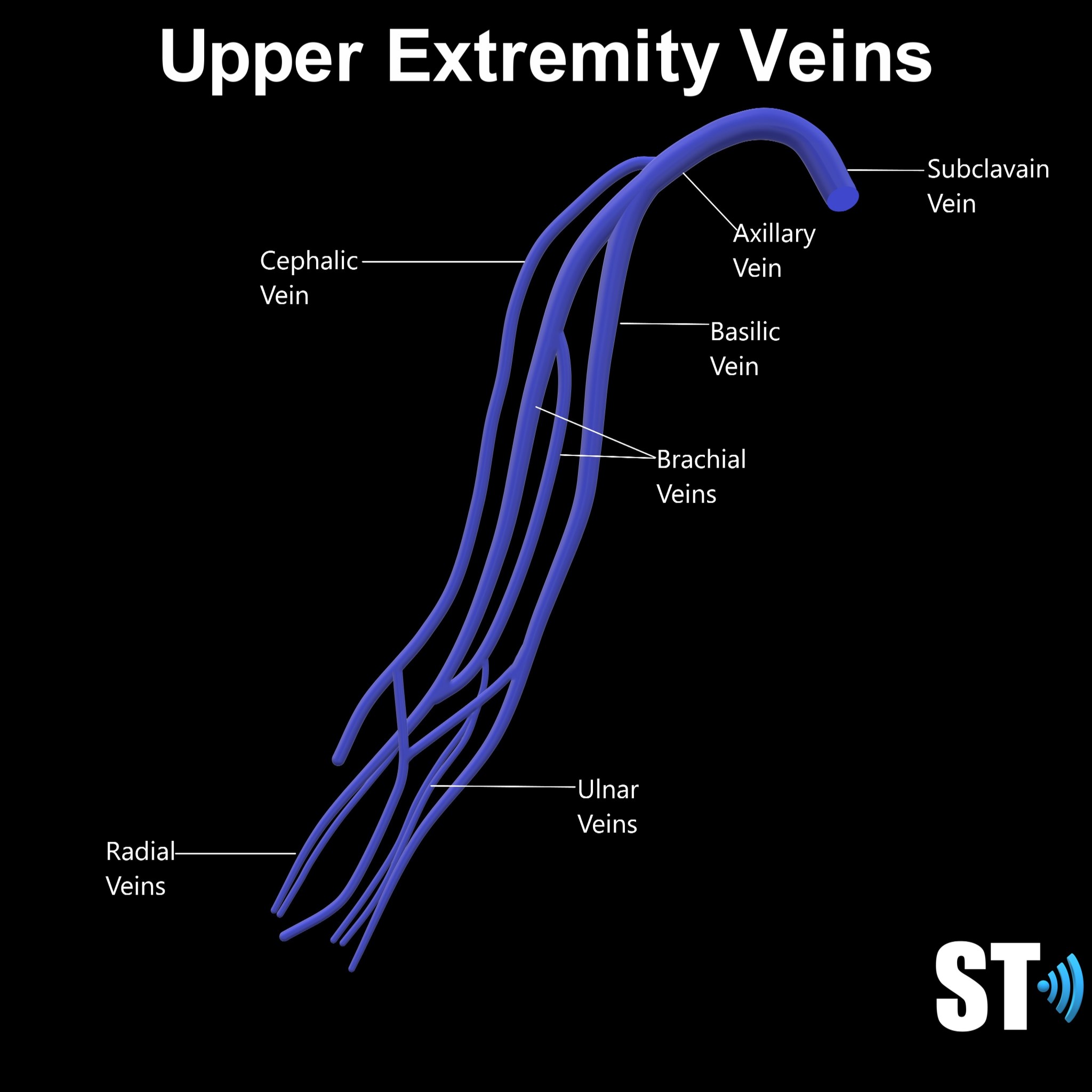 Upper Extremity Venous Doppler – Sonographic Tendencies