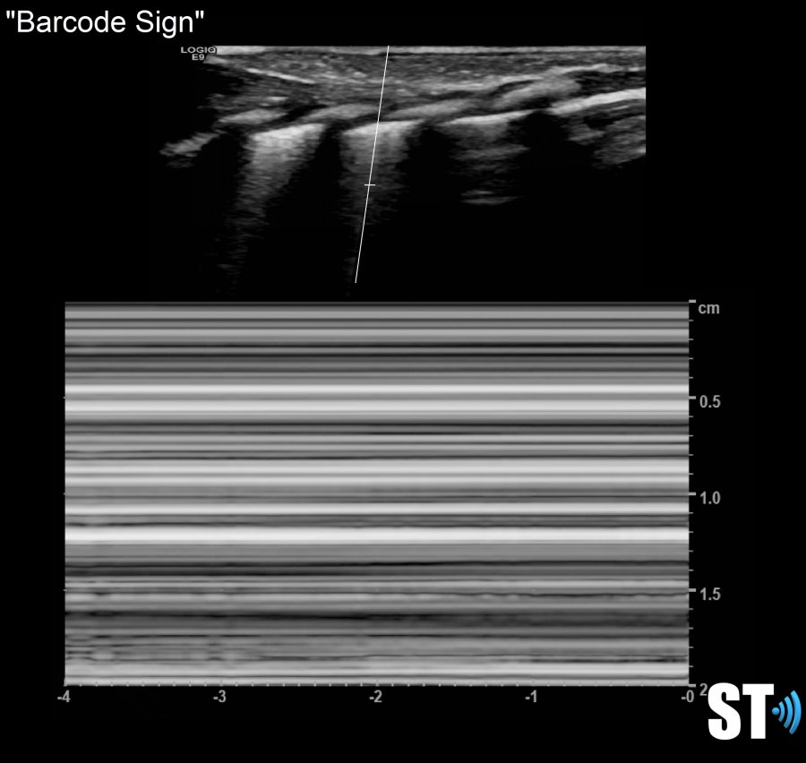 Chest and Lung Ultrasound – Sonographic Tendencies