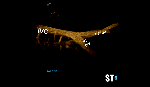 Lower Extremity Venous Duplex Protocol – Sonographic Tendencies