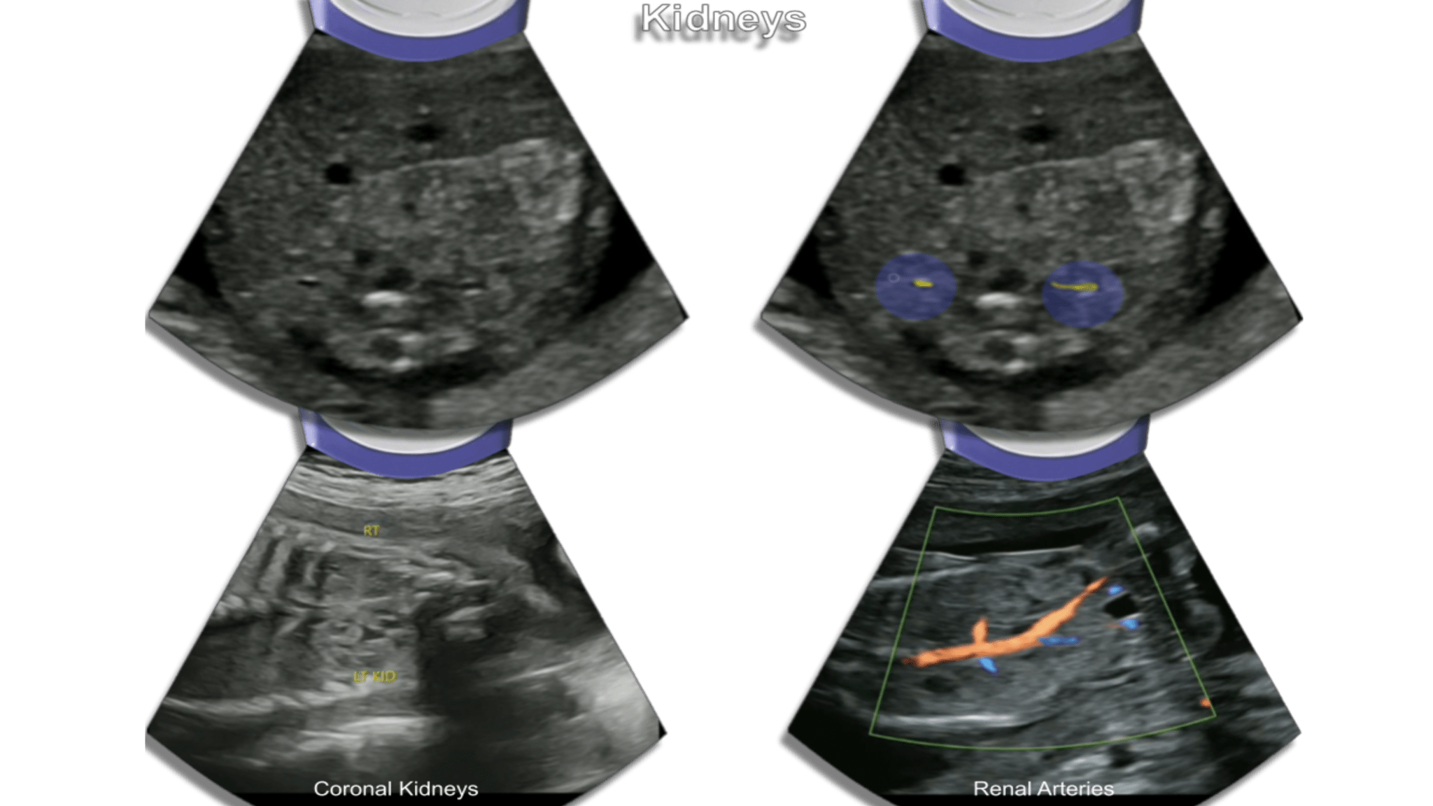 OB Ultrasound Second Trimester (The Basics) – Sonographic Tendencies