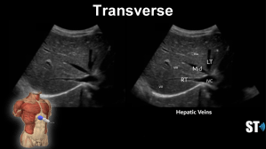 Liver Anatomy and Protocol – Sonographic Tendencies