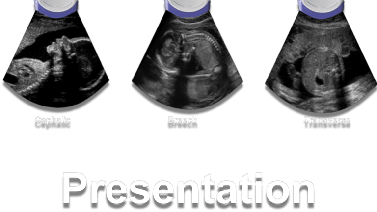 OB Ultrasound Second Trimester (The Basics) – Sonographic Tendencies