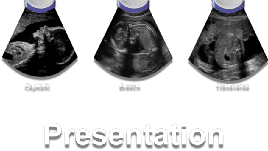 OB Ultrasound Second Trimester (The Basics) – Sonographic Tendencies