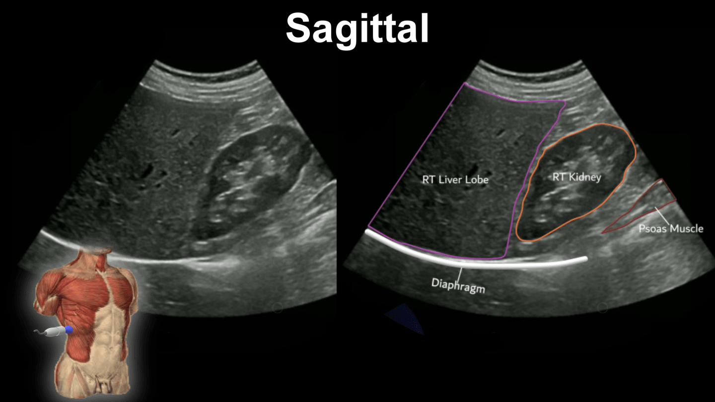 Liver Anatomy and Protocol – Sonographic Tendencies