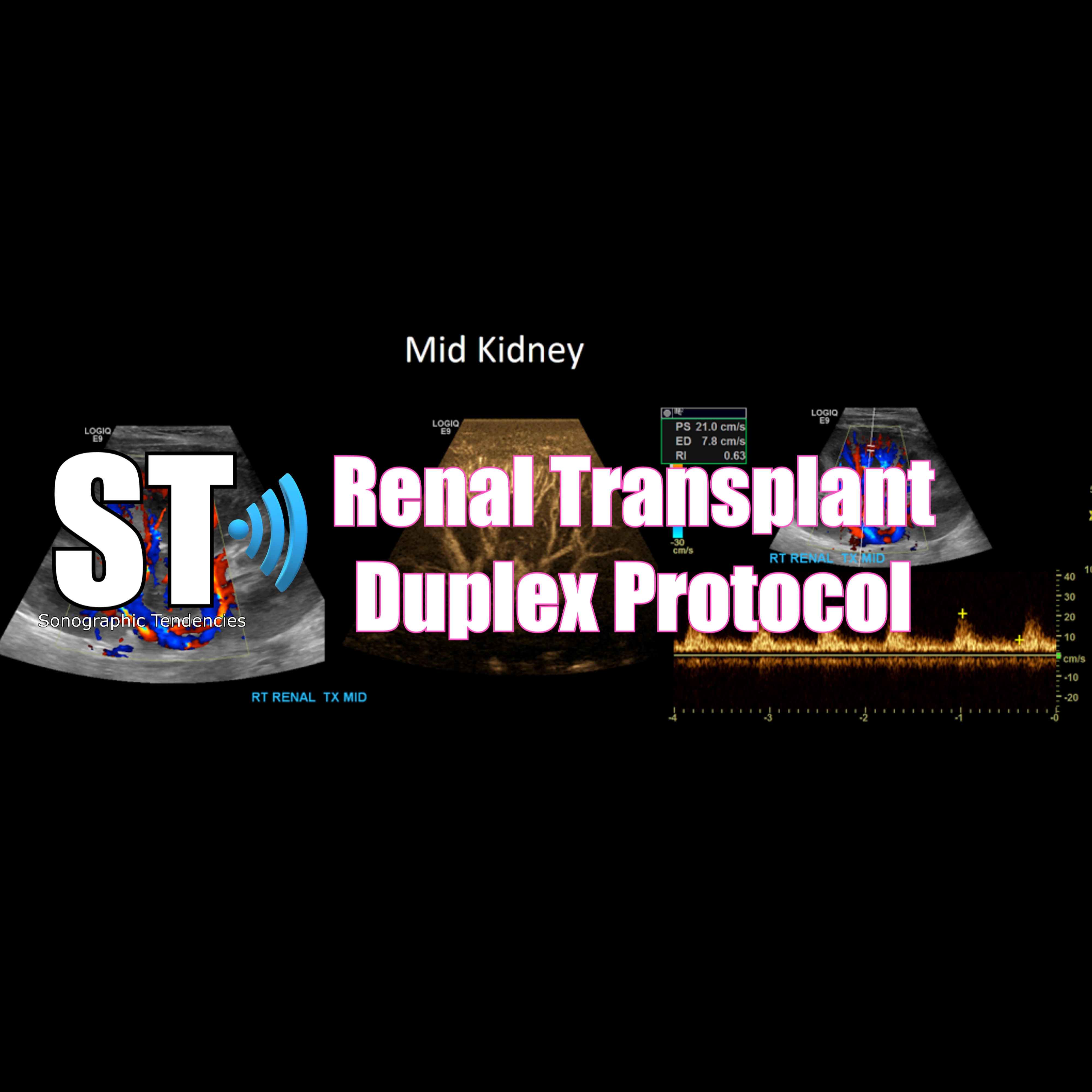 vascular – Sonographic Tendencies