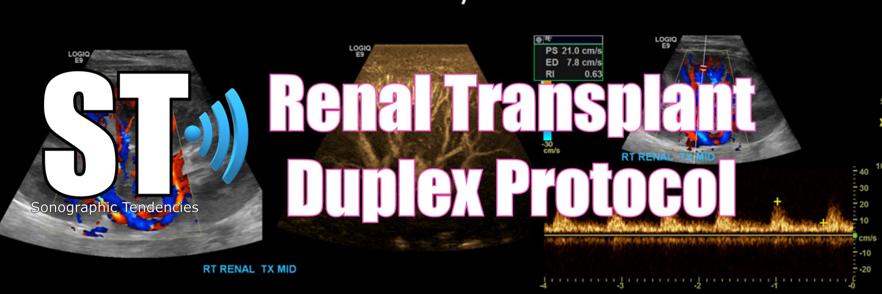 Protocols Sonographic Tendencies 5252