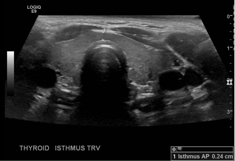 Thyroid Ultrasound Protocol – Sonographic Tendencies