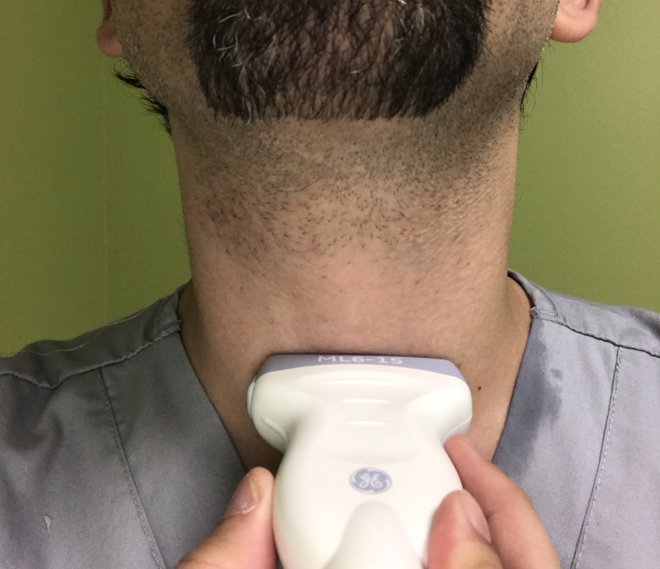 Thyroid Ultrasound Protocol – Sonographic Tendencies