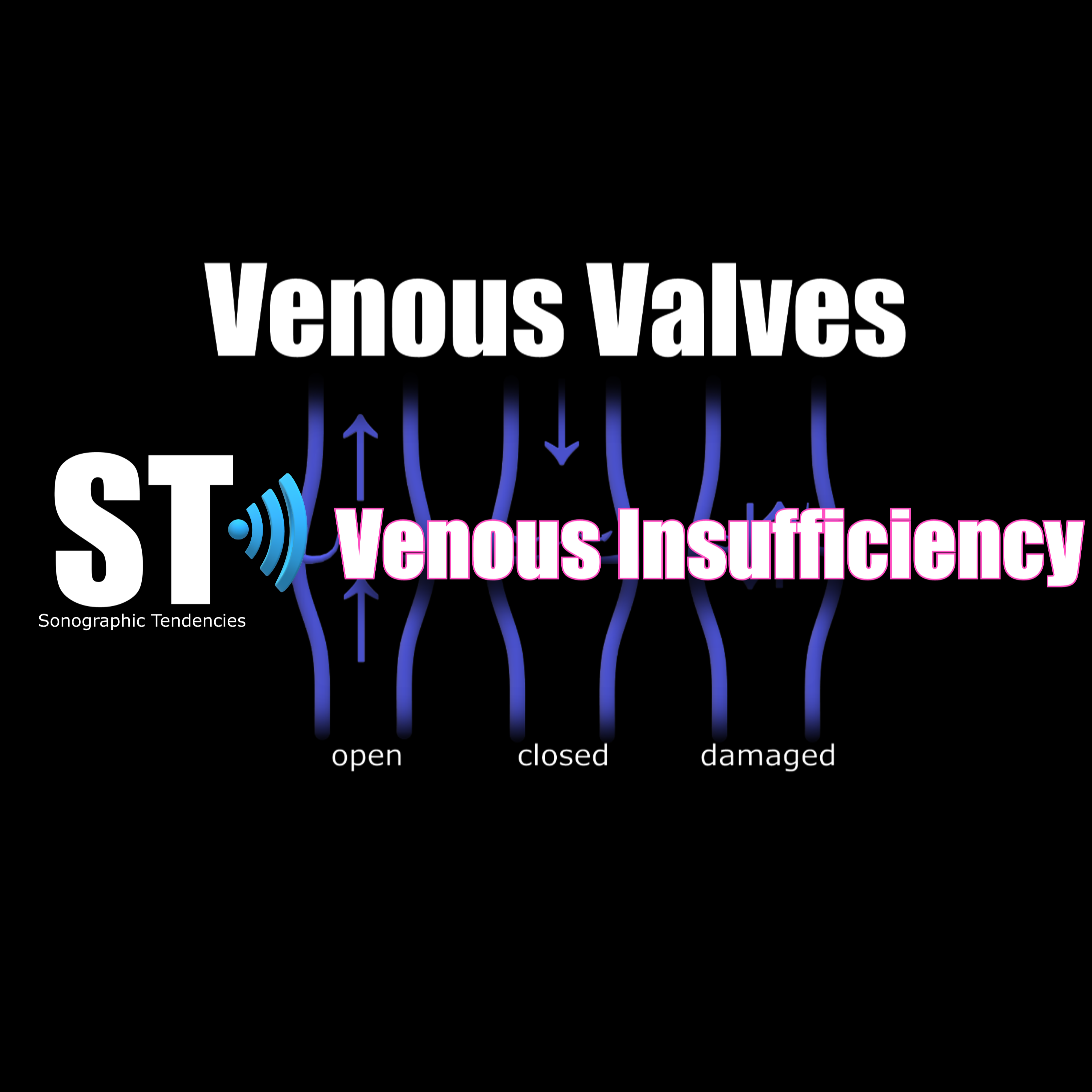 Venous Insufficiency Case/Protocol – Sonographic Tendencies