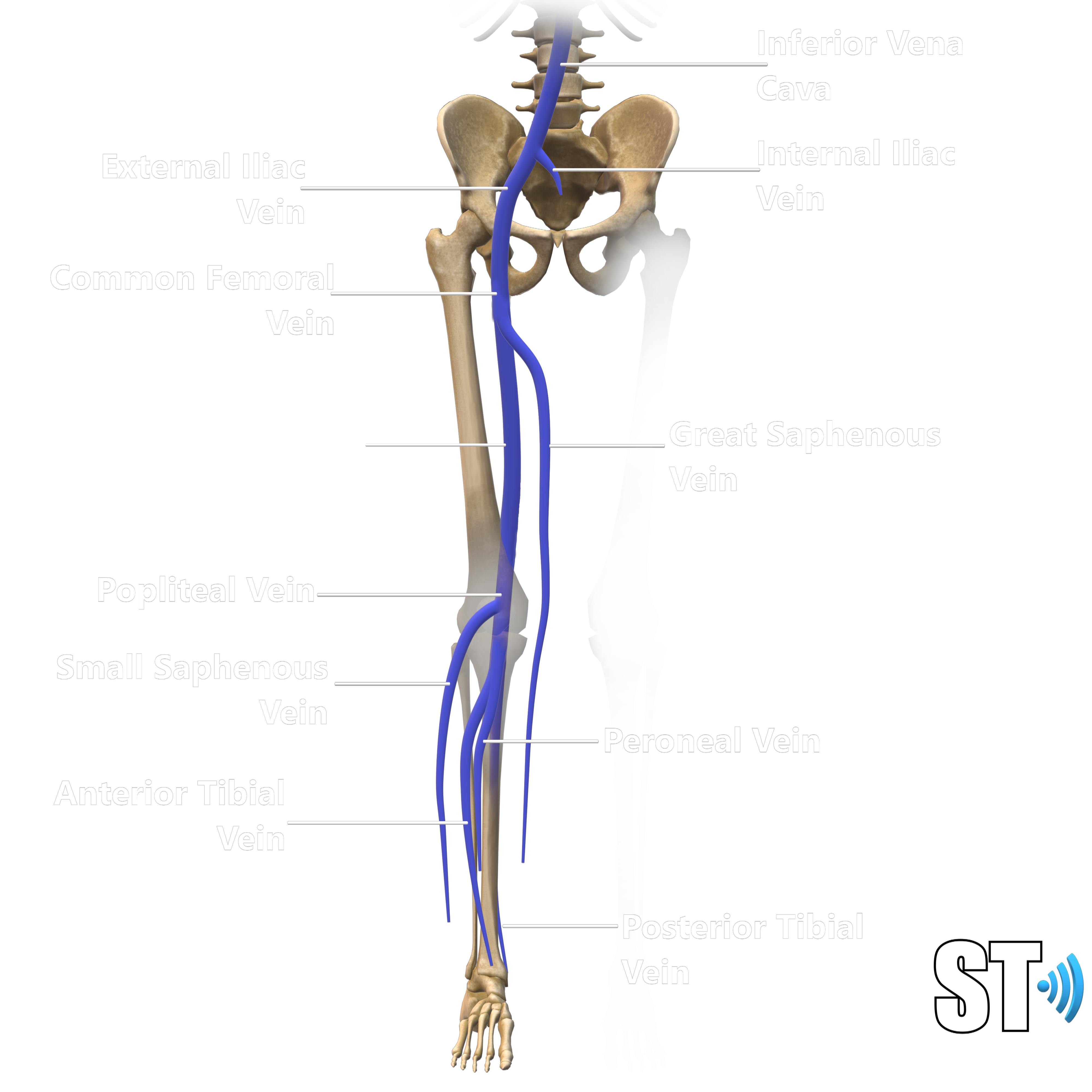 Venous Insufficiency Case/Protocol – Sonographic Tendencies