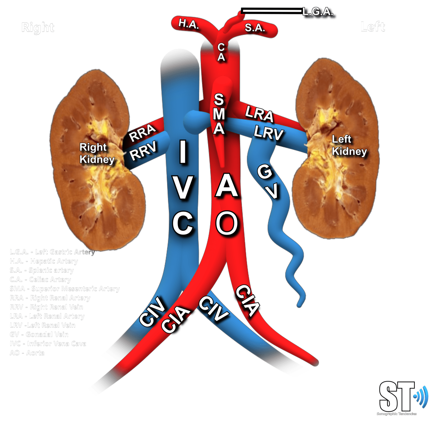 Nutcracker Phenomenon/Syndrome – Sonographic Tendencies