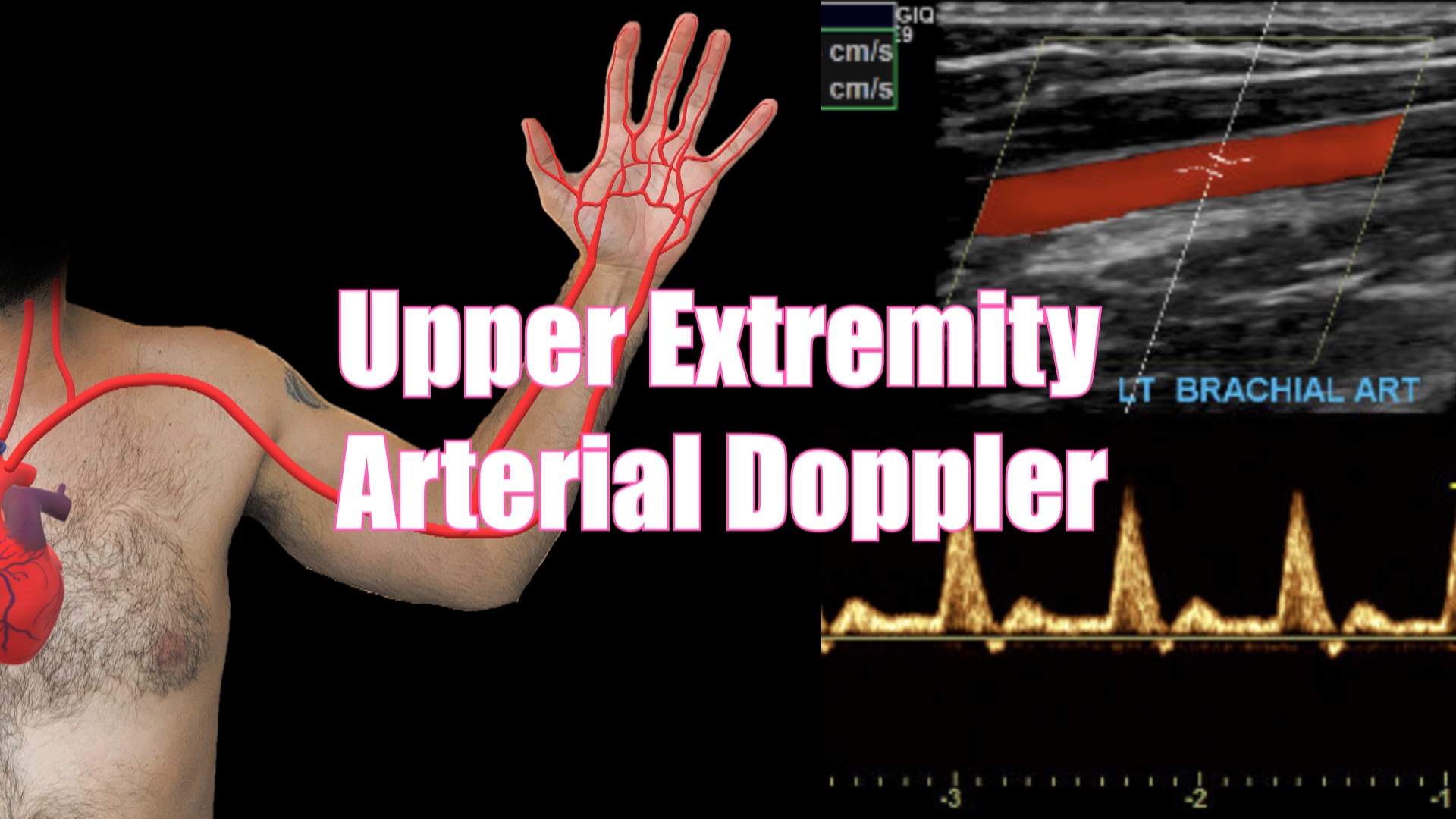 vascular – Sonographic Tendencies
