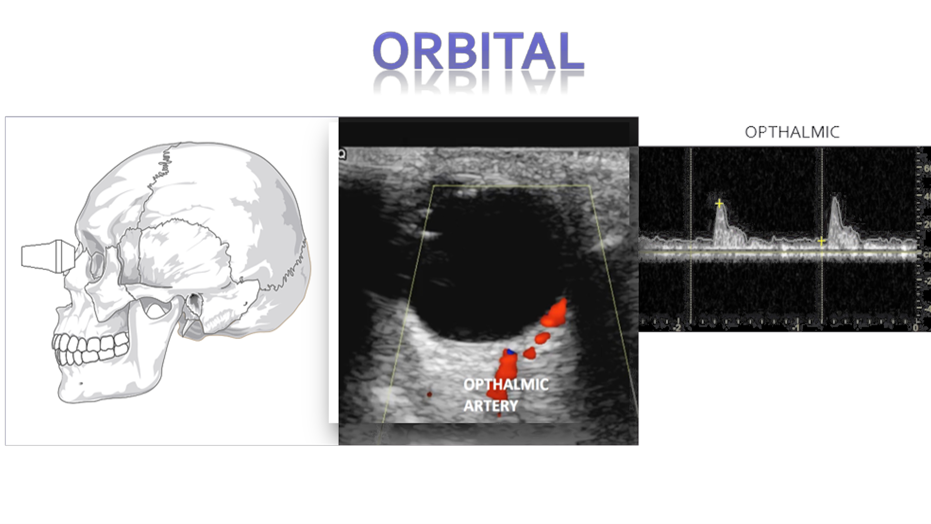 Ocular Ultrasound – Sonographic Tendencies