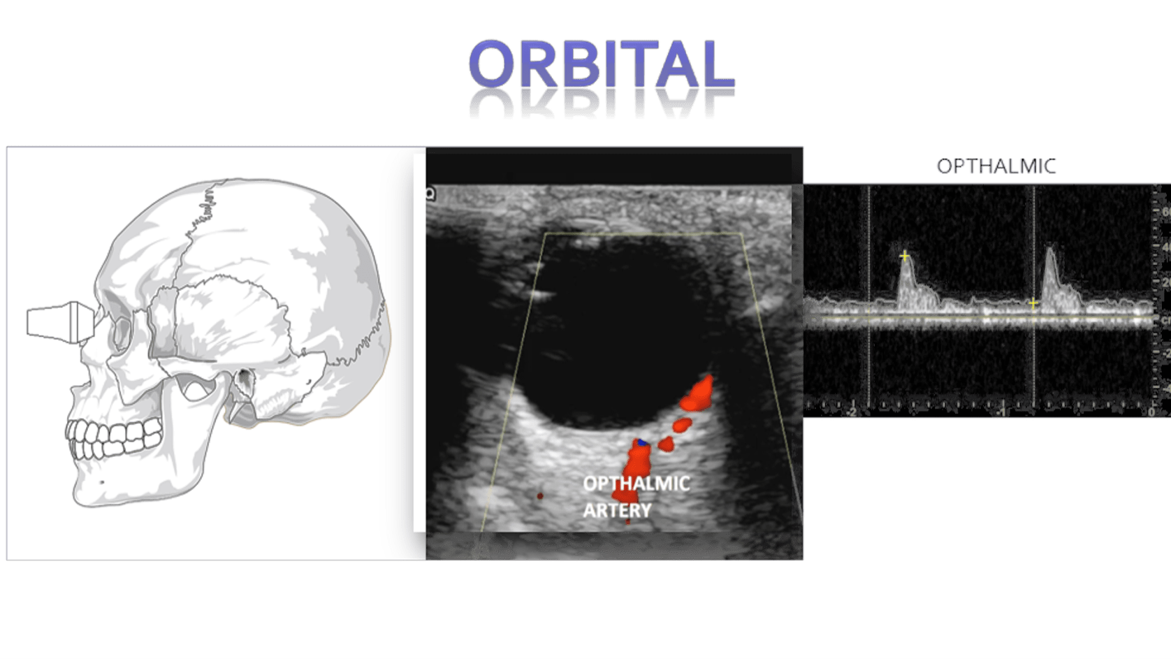 Ocular Ultrasound – Sonographic Tendencies