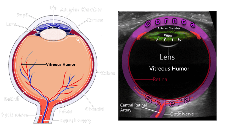 Ocular Ultrasound – Sonographic Tendencies