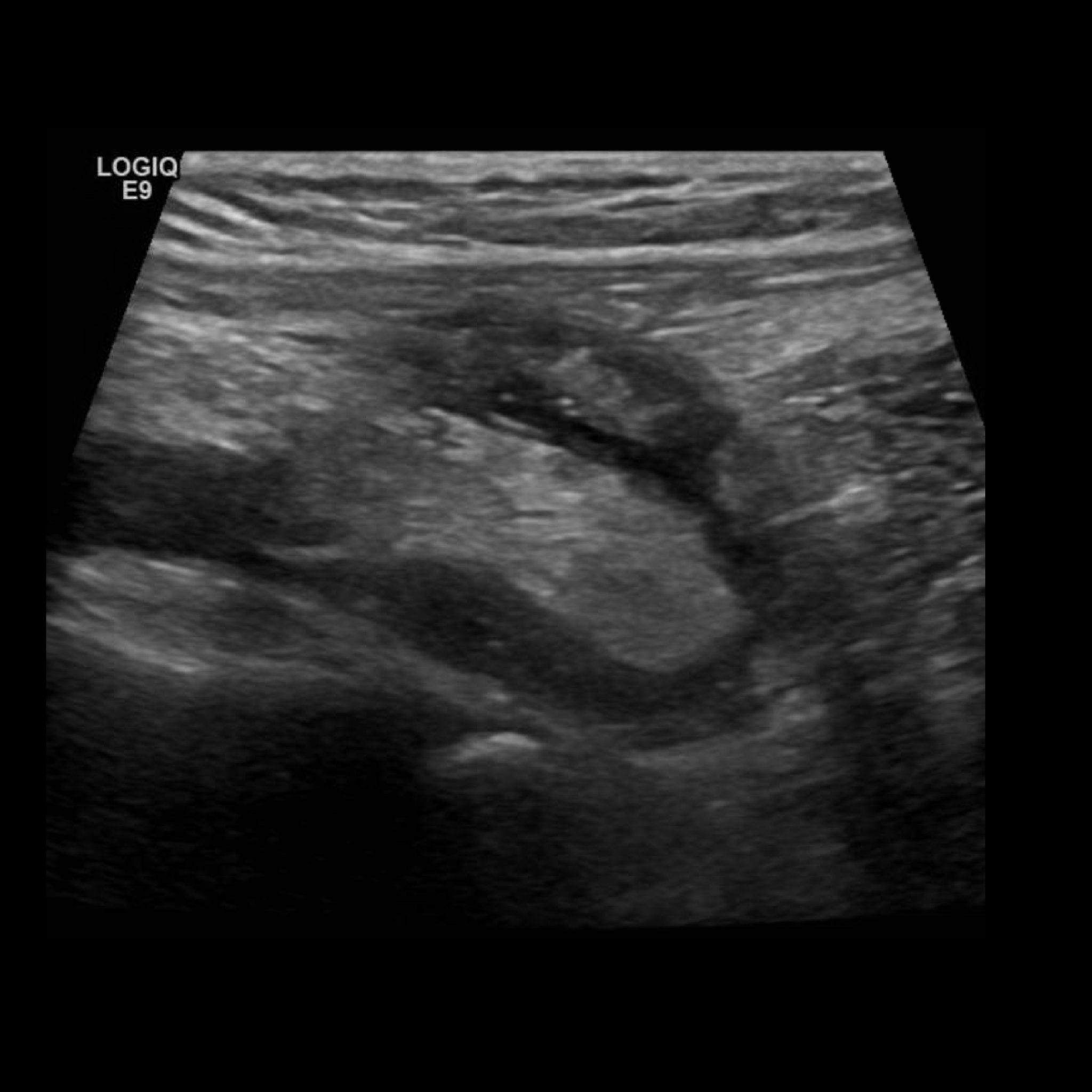 Appendix Gallery – Sonographic Tendencies