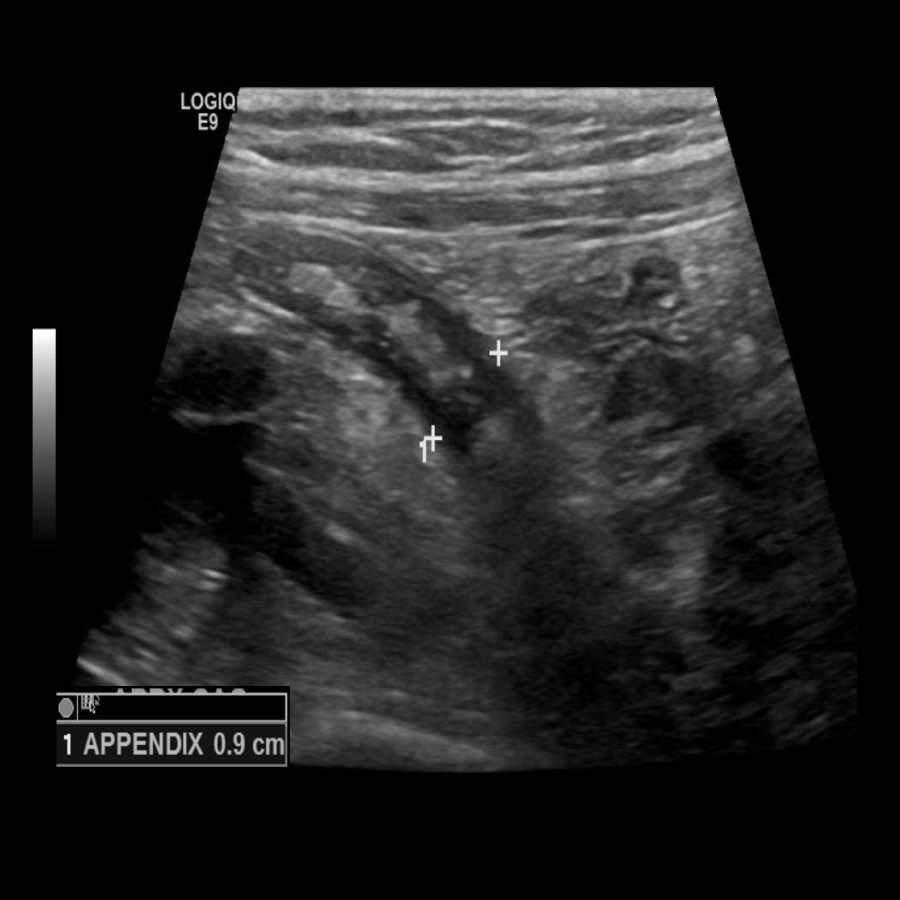 Appendix Gallery – Sonographic Tendencies