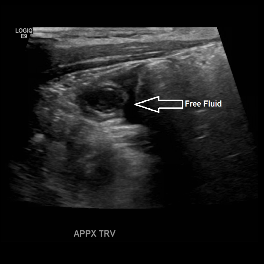 Appendix Gallery – Sonographic Tendencies
