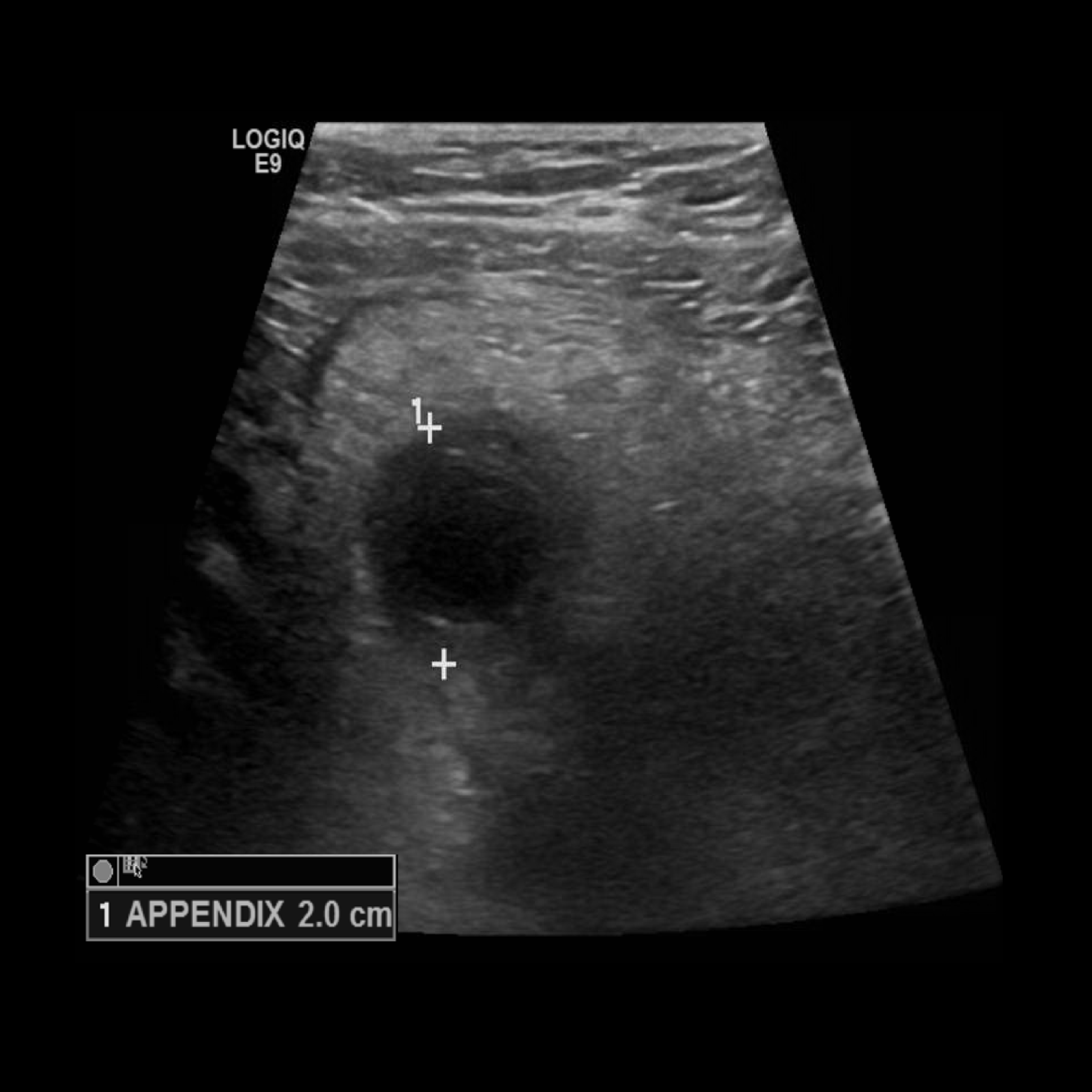 Appendix Gallery – Sonographic Tendencies