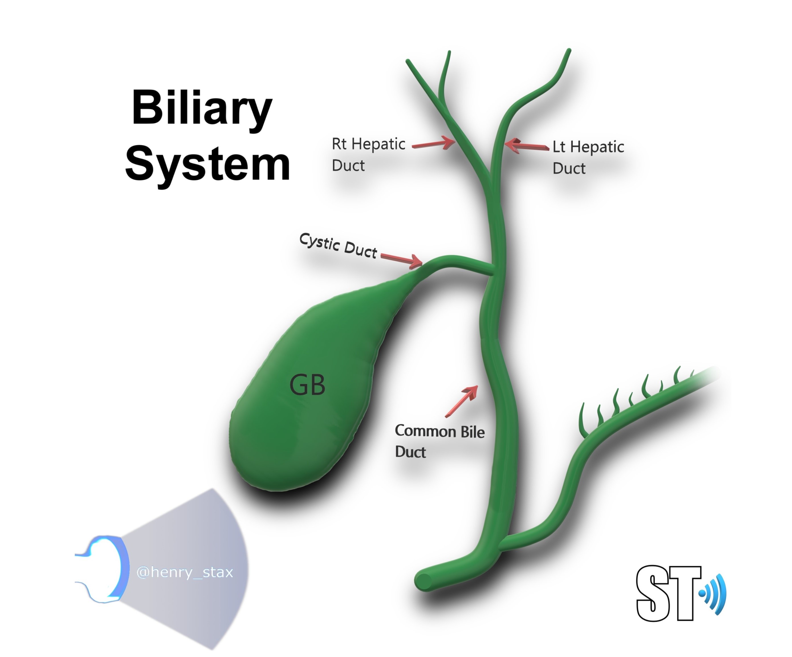 Choledochal Cyst – Sonographic Tendencies