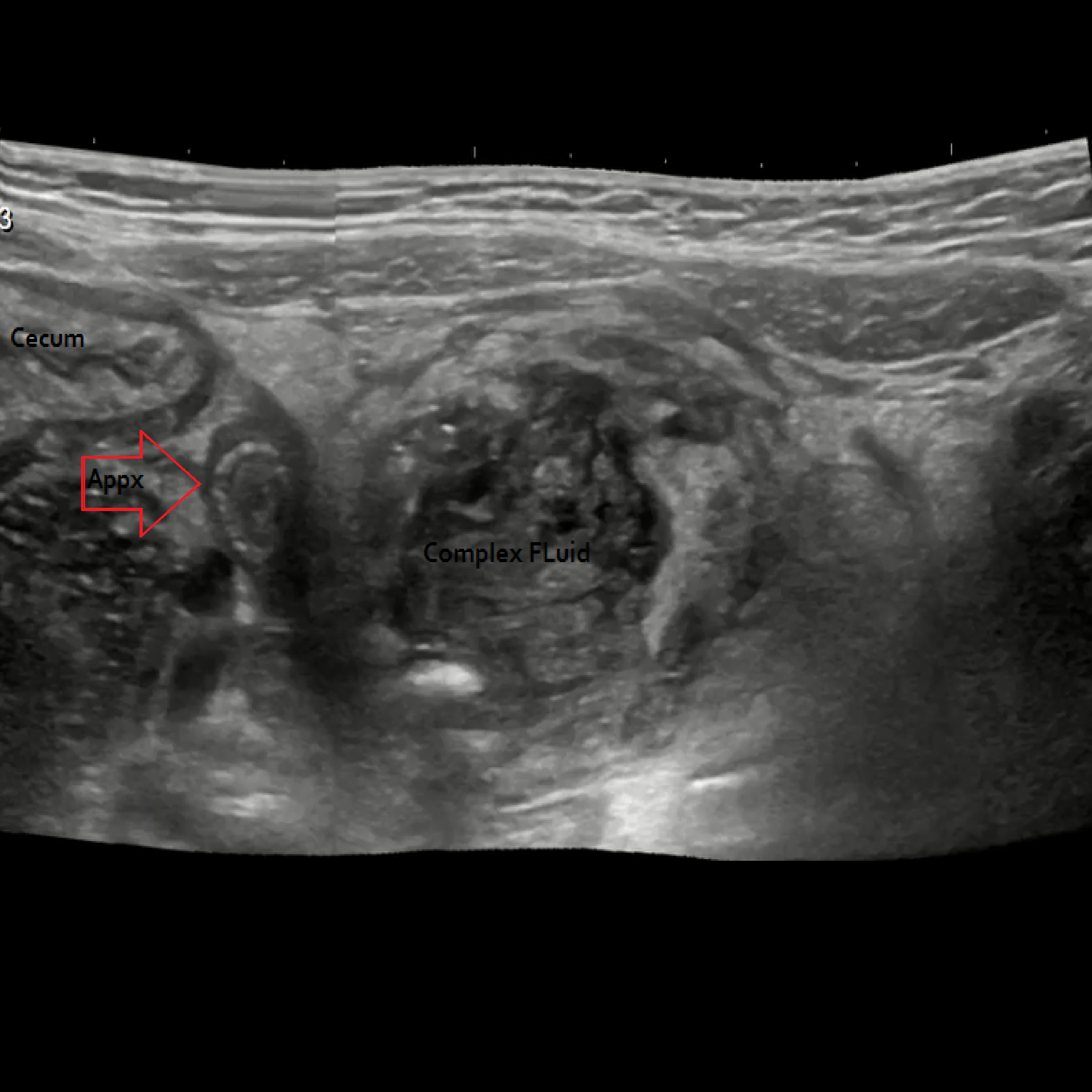 Appendix Gallery – Sonographic Tendencies